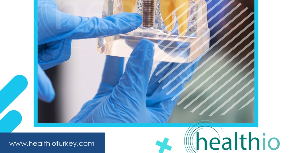 Dental Implant Consultation in Antalya | GetYourGuide