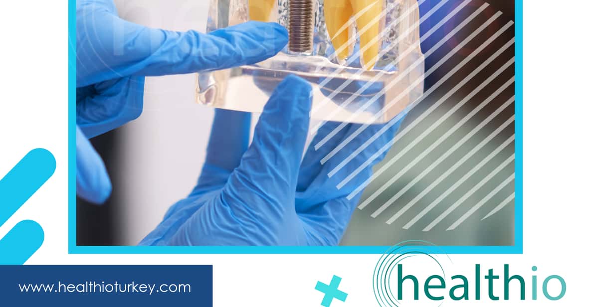 Dental Implant Consultation in Antalya | GetYourGuide